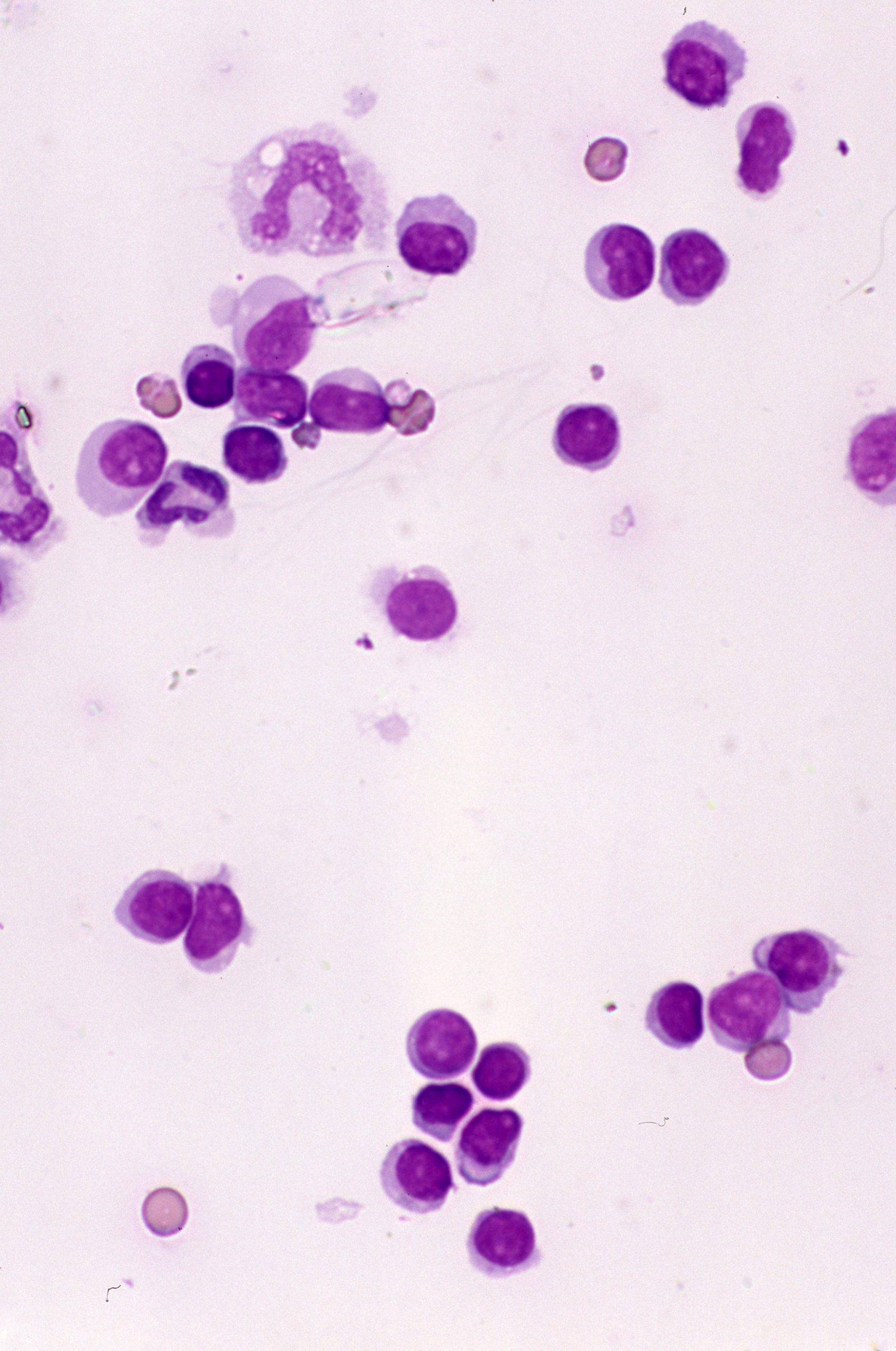 Lymphocytes – Clinical Laboratory Science